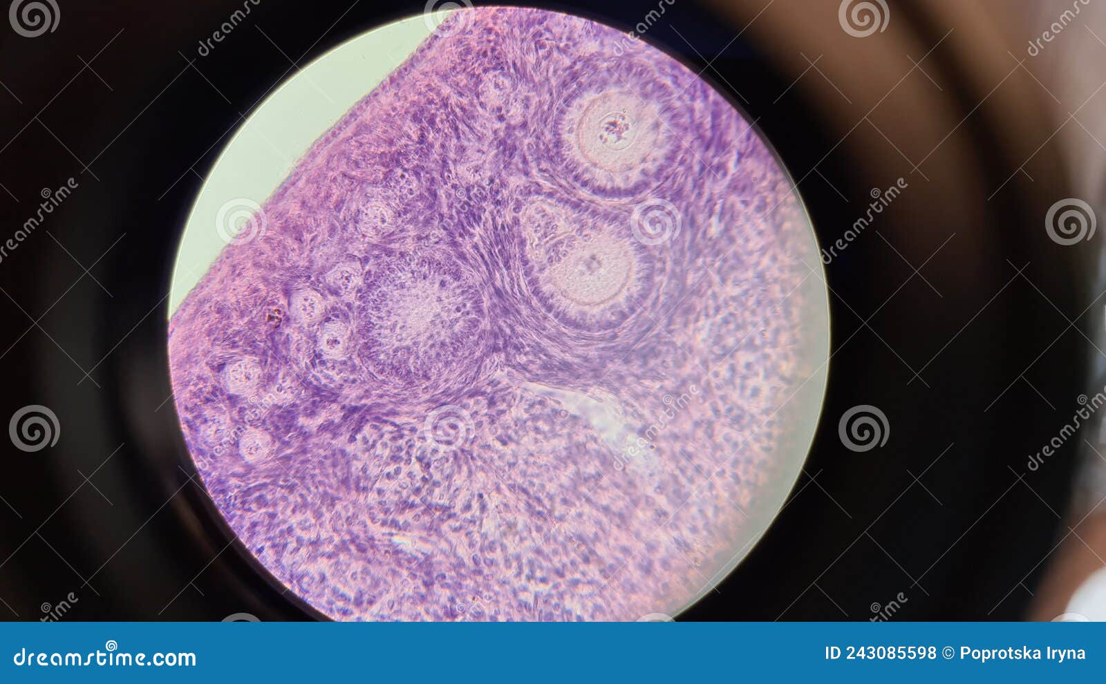 Mammalian Ovary Under a Microscope Stock Photo - Image of membrane ...
