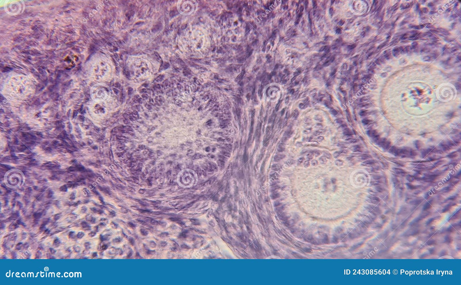 Section of a Mammalian Ovary Under a Microscope Stock Photo - Image of ...