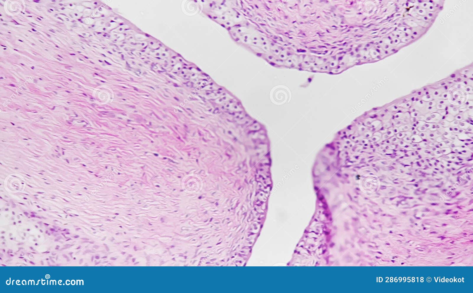 Section of Man Transitional Epithelium Filmed Under Microscope 200x on ...