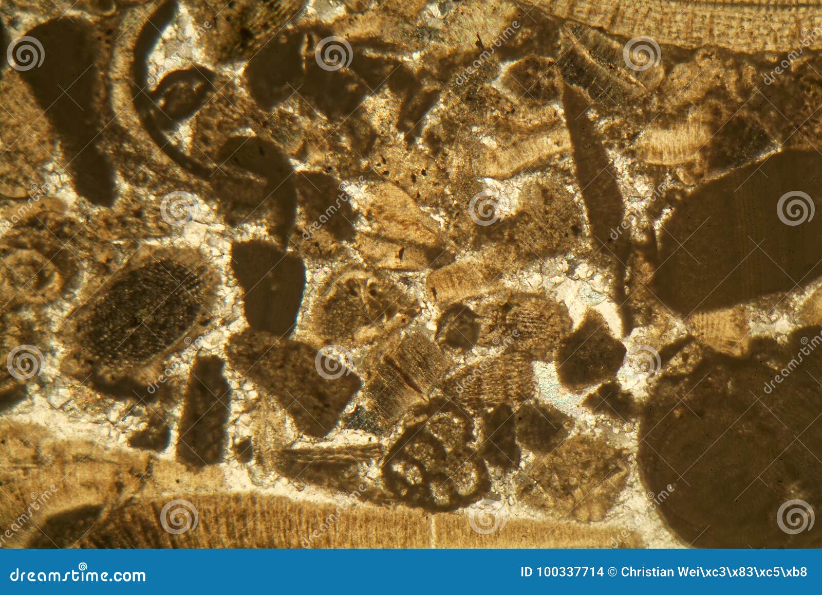 Section Mince De Chaux Miocène Sous Le Microscope Photo stock - Image ...