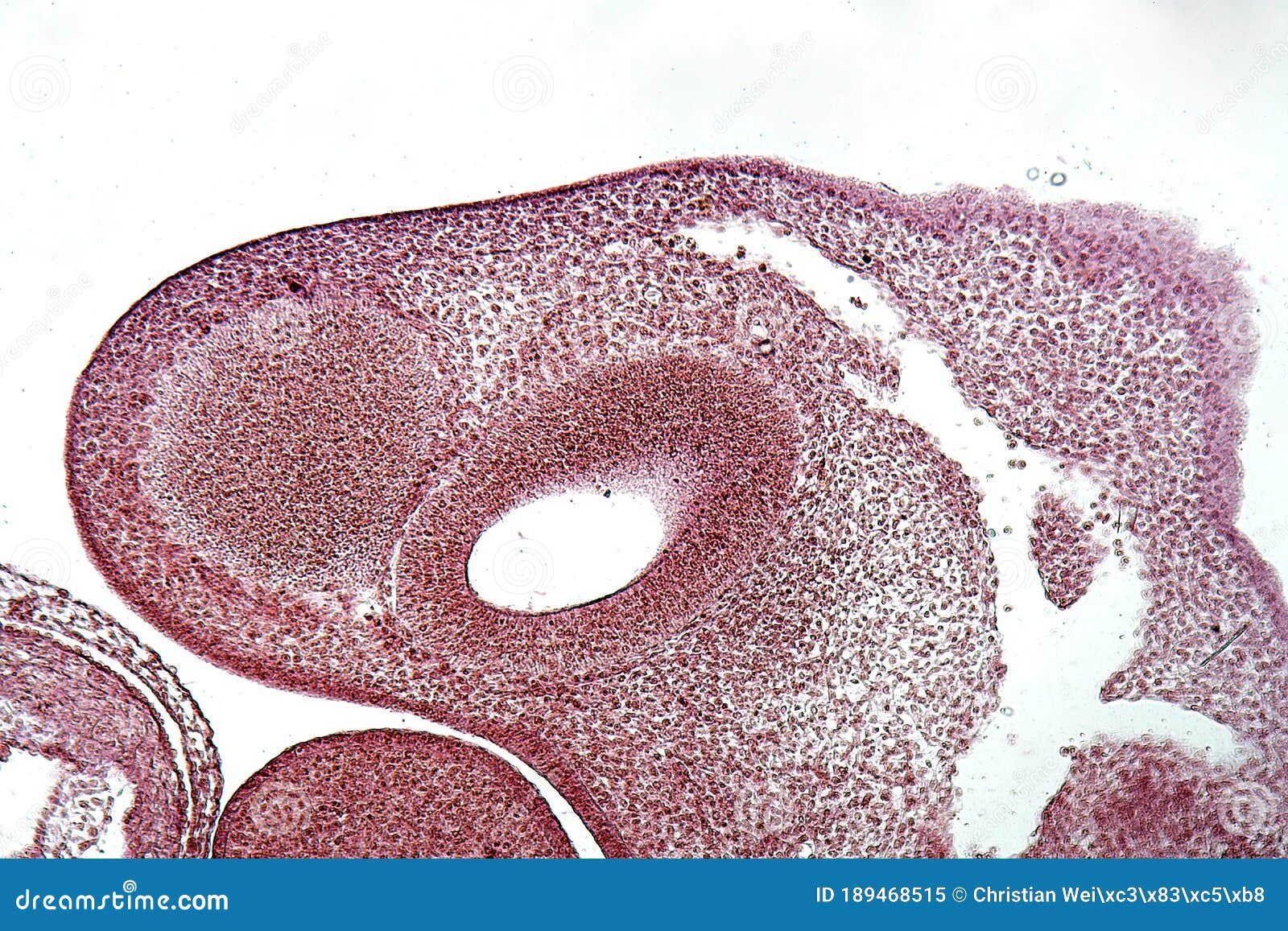 Section of a Porcine Embryo Head Under the Microscope Stock Image ...