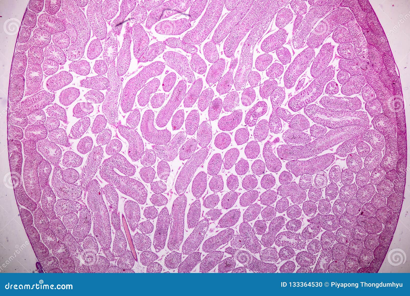 Section of Testis Tissue Under the Microscope . Stock Photo - Image of ...
