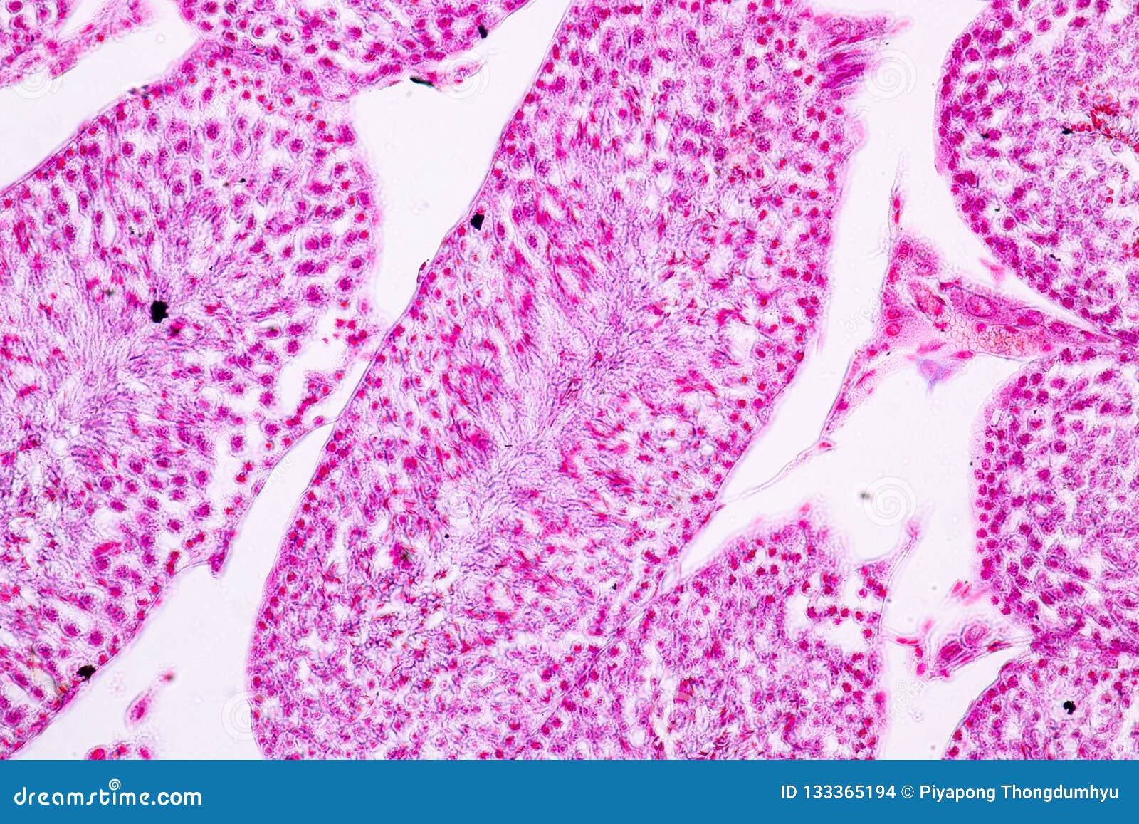 Section of Testis Tissue Under the Microscope . Stock Photo - Image of ...