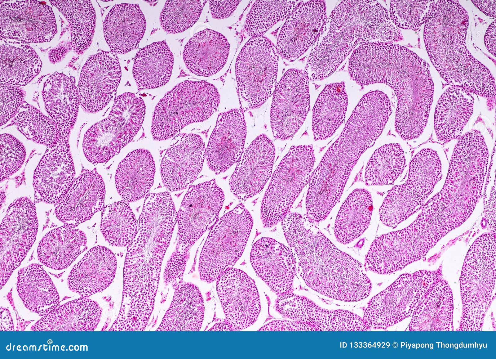 Section Of Testis Tissue Under The Microscope Stock Image Image Of Human Micro 133364929
