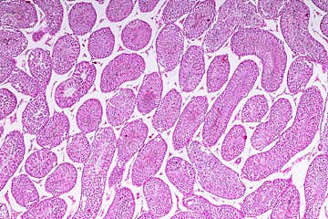 Section of Testis Tissue Under the Microscope . Stock Image - Image of ...