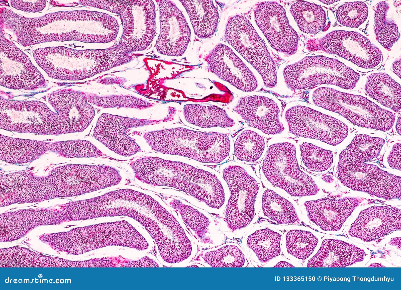 Section of Testis Tissue Under the Microscope . Stock Photo - Image of ...