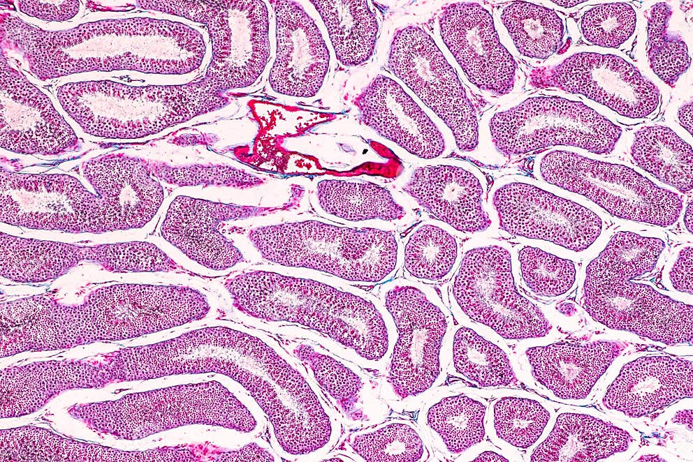 Section of Testis Tissue Under the Microscope . Stock Photo - Image of ...