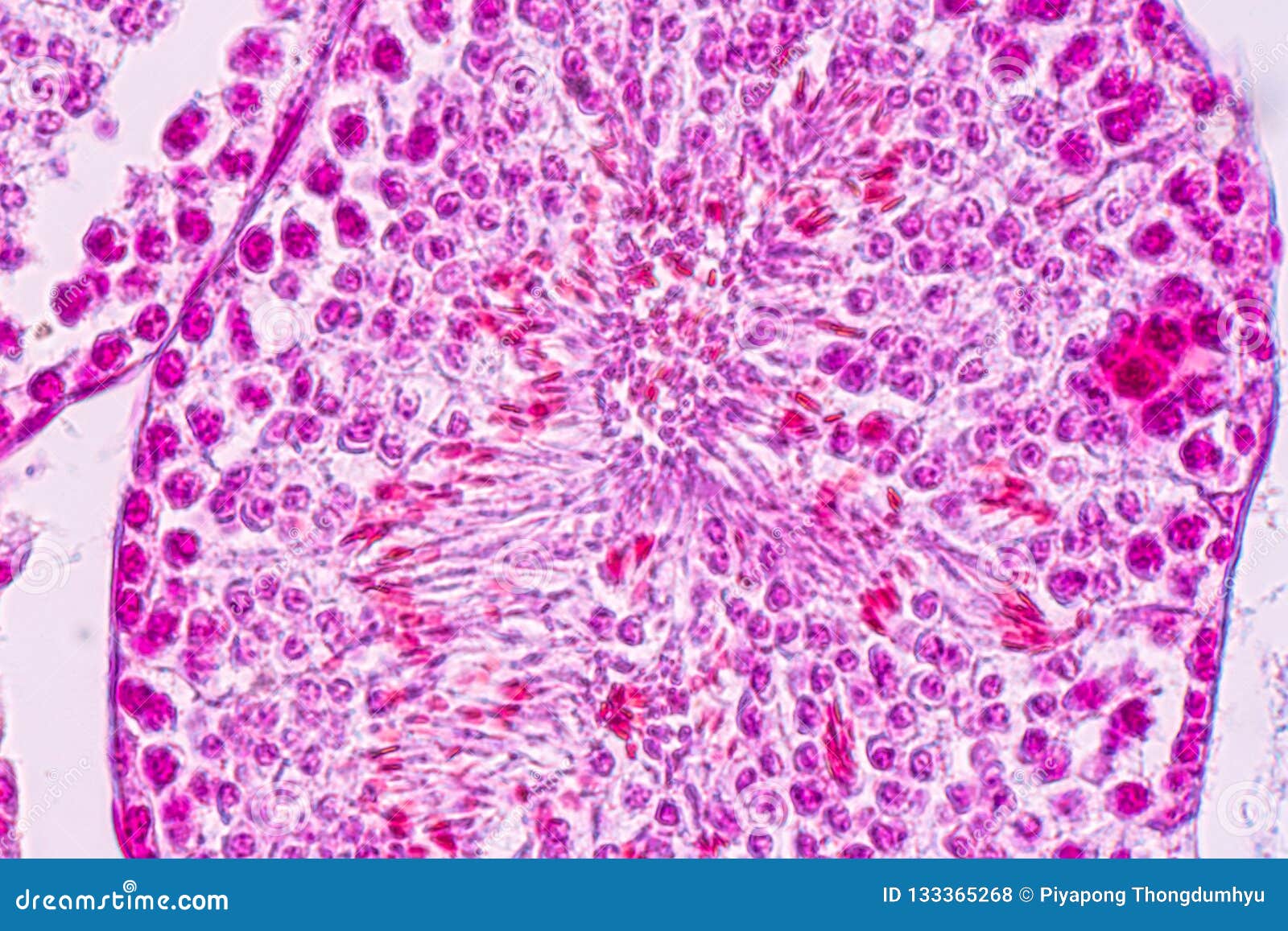 Section of Testis Tissue Under the Microscope . Stock Photo - Image of ...