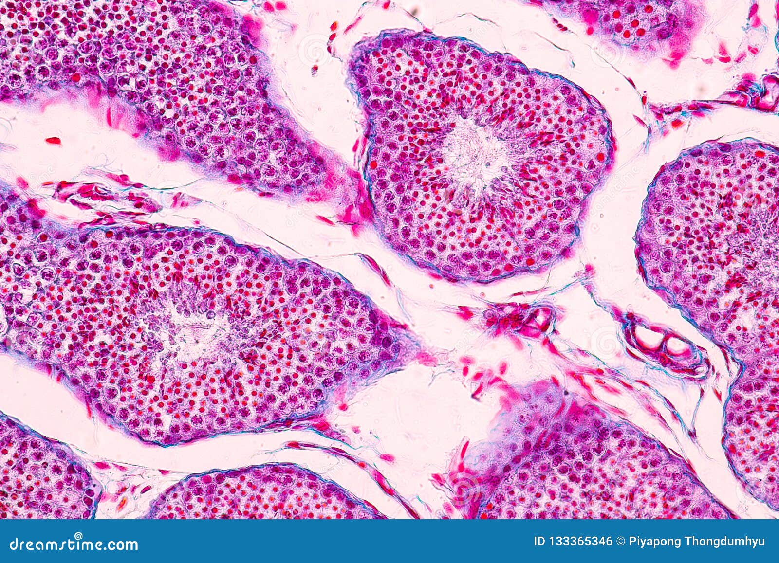 Section of Testis Tissue Under the Microscope . Stock Photo - Image of ...