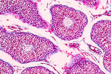 Section of Testis Tissue Under the Microscope . Stock Photo - Image of ...
