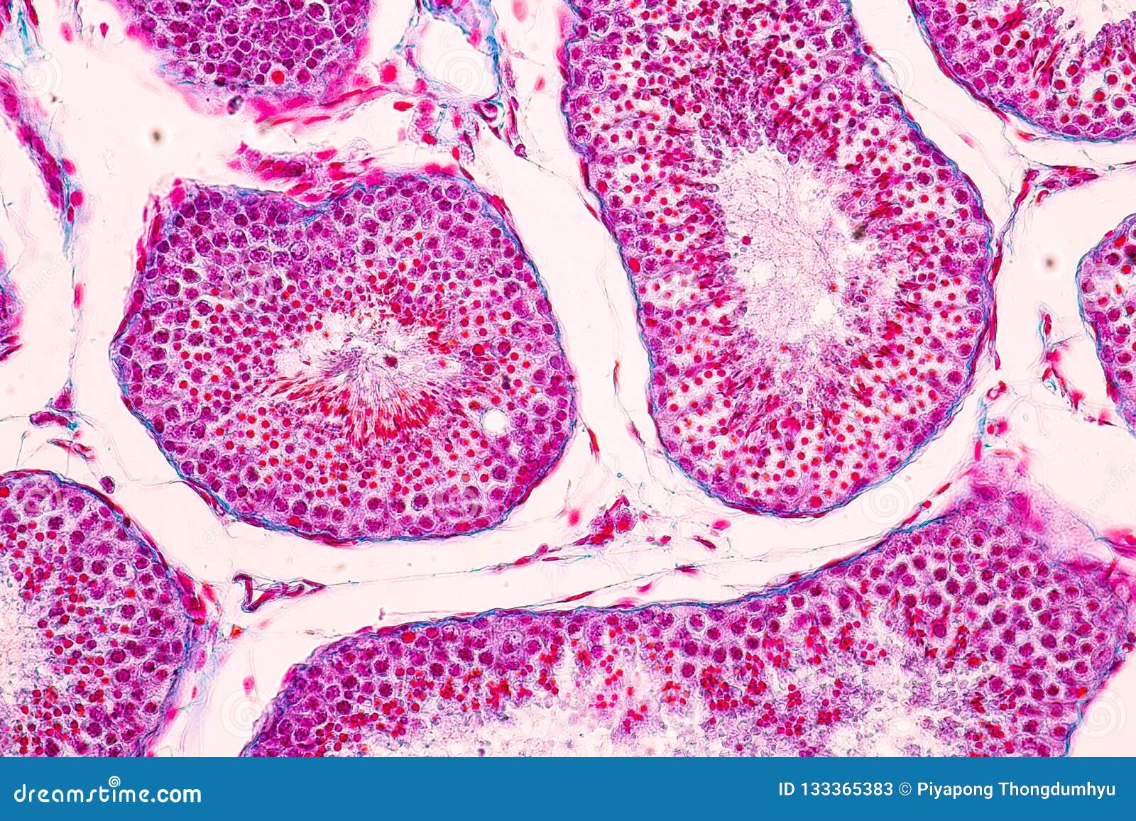 Section of Testis Tissue Under the Microscope . Stock Image - Image of ...