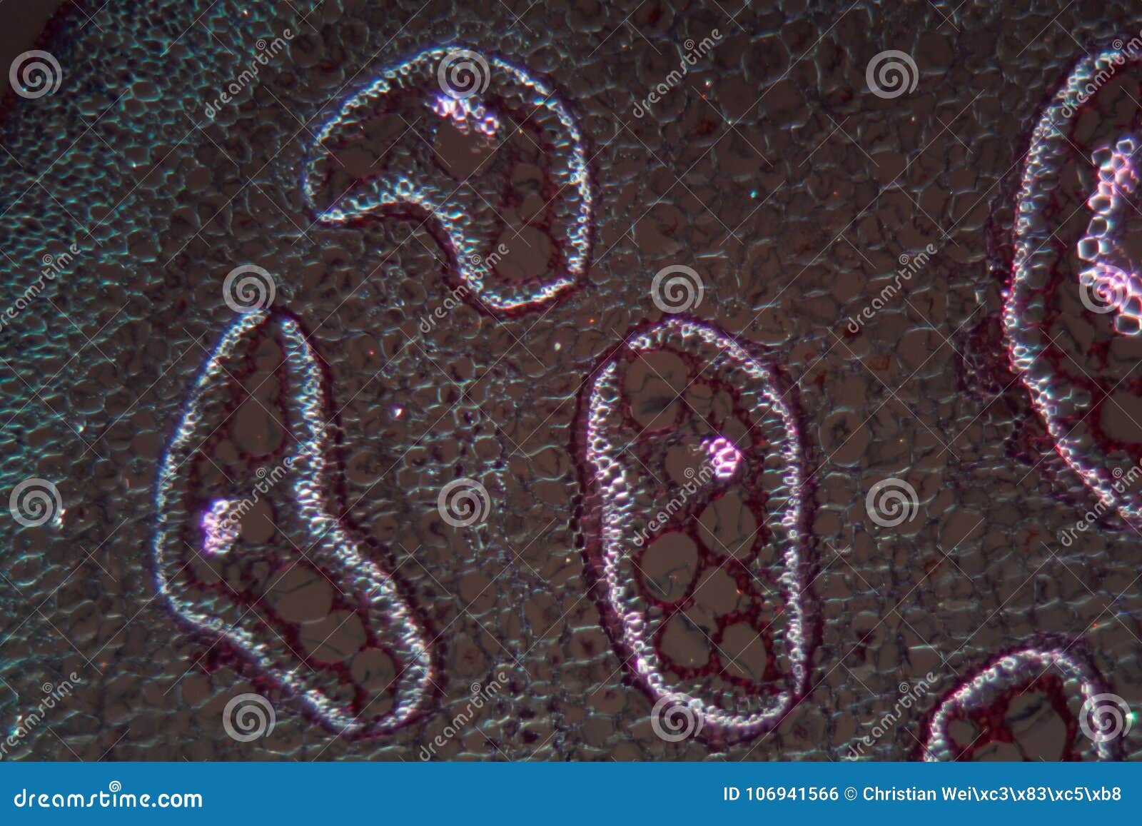 Fern Stem Under the Microscope and in Polarized Light. Stock Photo ...