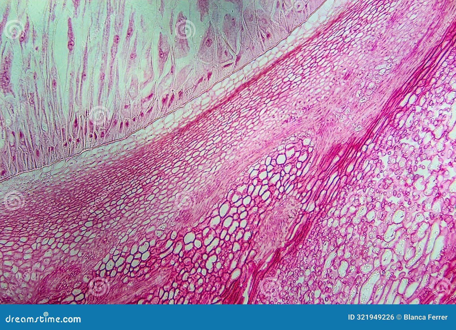 Seed of Corn Under the Microscope Magnified 100X Stock Photo - Image of ...