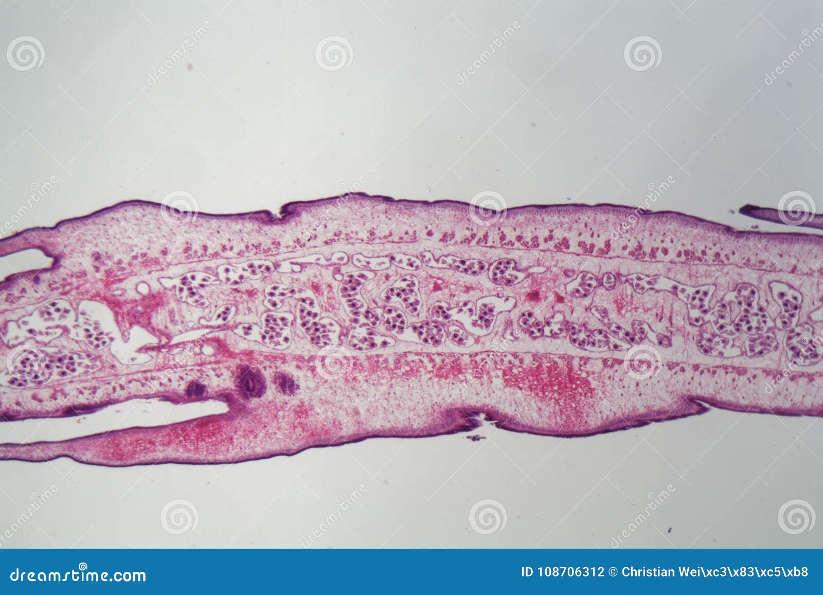 Segment of a Tapeworm Body Proglottid Stock Photo - Image of microscopy ...