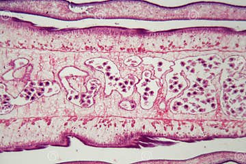 Segment of a Tapeworm Body Proglottid Stock Photo - Image of medicine ...