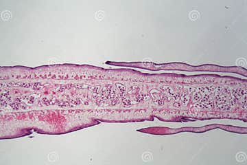 Segment of a Tapeworm Body Proglottid Stock Photo - Image of infection ...