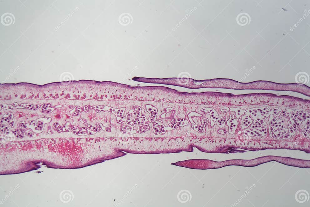 Segment of a Tapeworm Body Proglottid Stock Photo - Image of infection ...