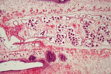 Segment of a Tapeworm Body Proglottid Stock Image - Image of organic ...