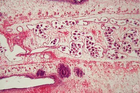 Segment of a Tapeworm Body Proglottid Stock Image - Image of organic ...
