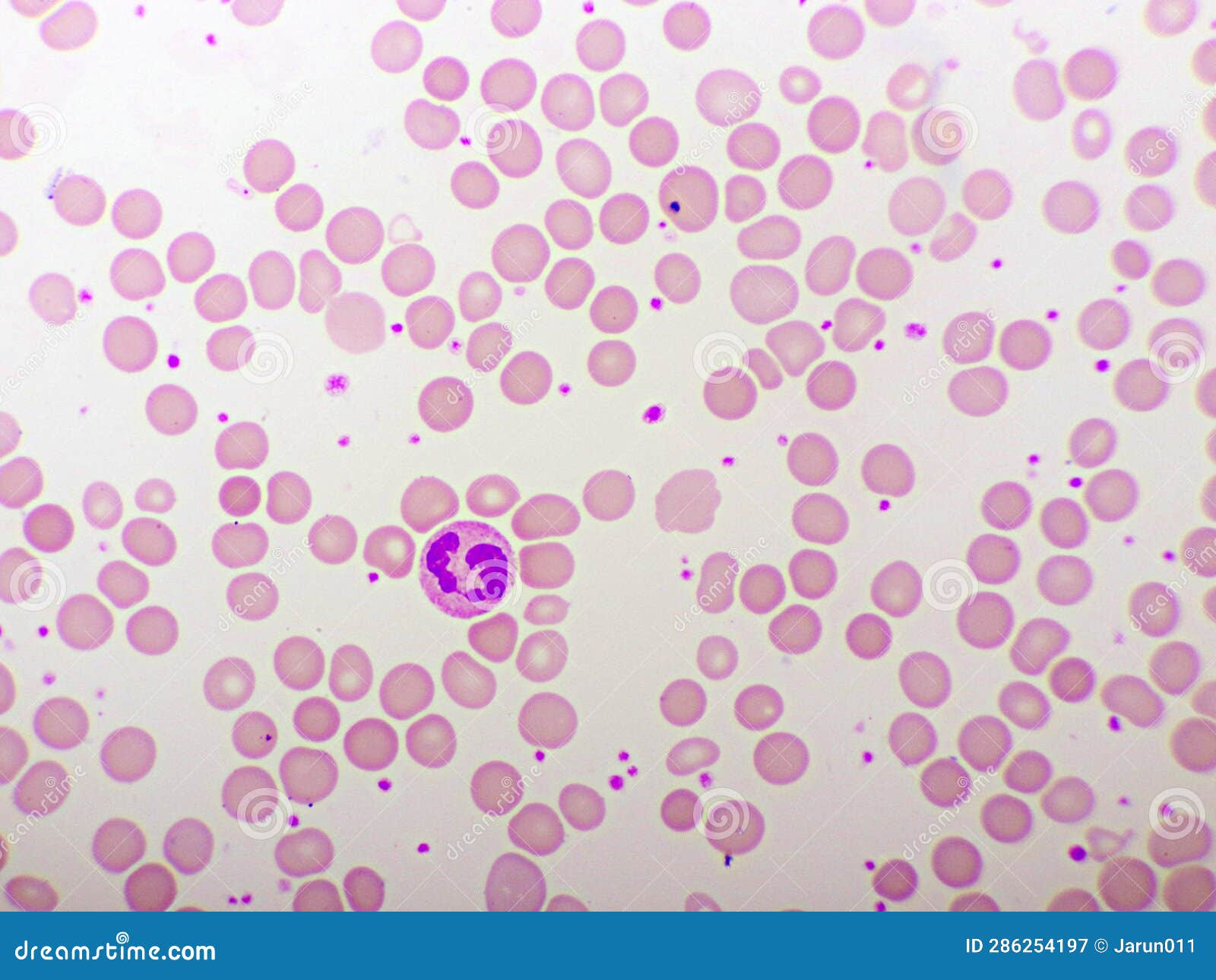 Segmented Neutrophil Cell in Human Blood Smear Stock Image - Image of ...