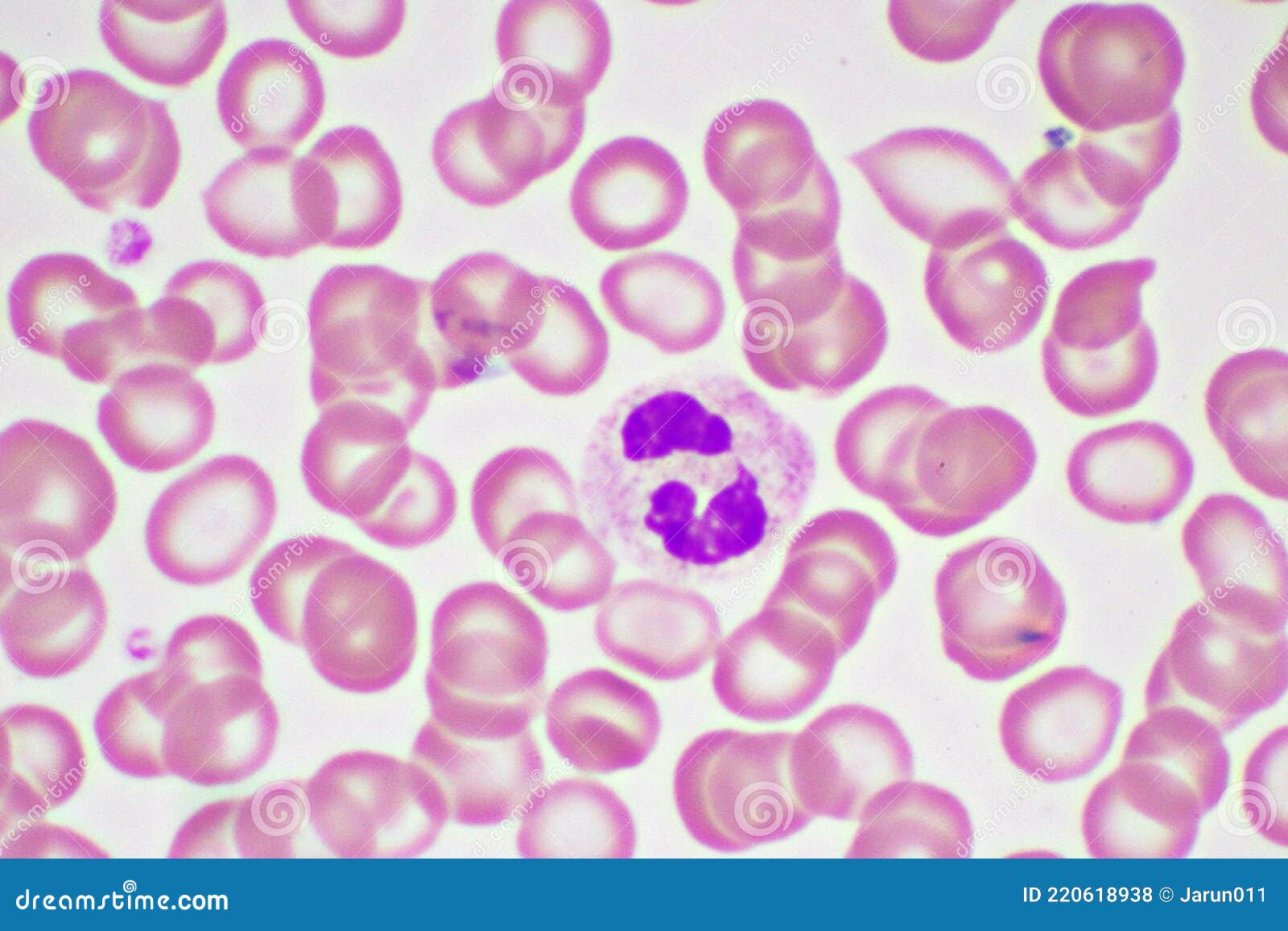 Segmented Neutrophil Cell in Human Blood Smear Stock Photo - Image of ...