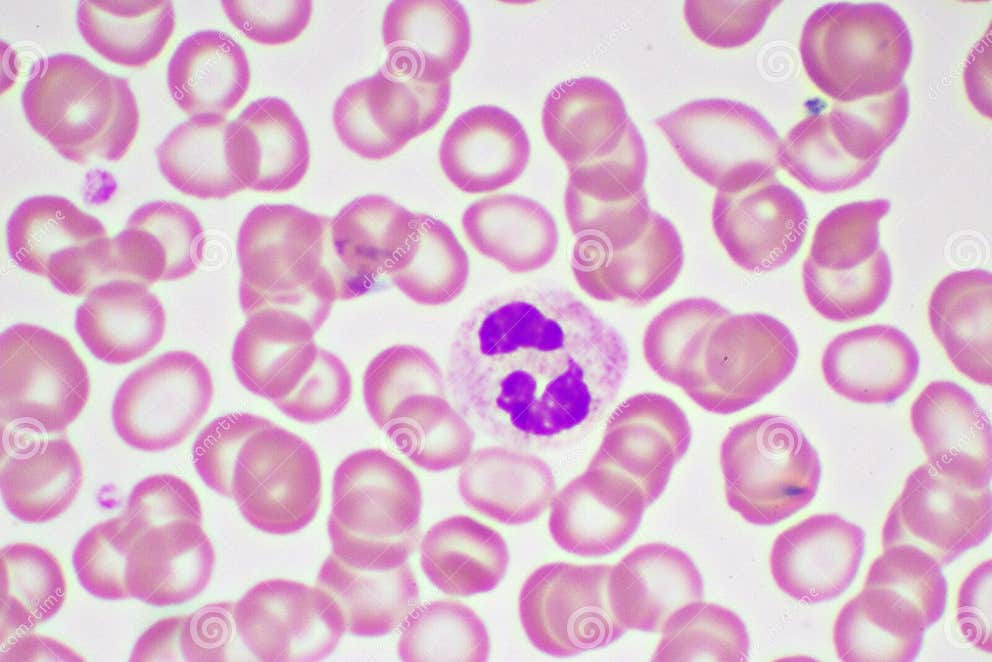 Segmented Neutrophil Cell in Human Blood Smear Stock Photo - Image of ...
