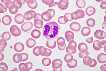 Segmented Neutrophil Cell in Human Blood Smear Stock Image - Image of ...