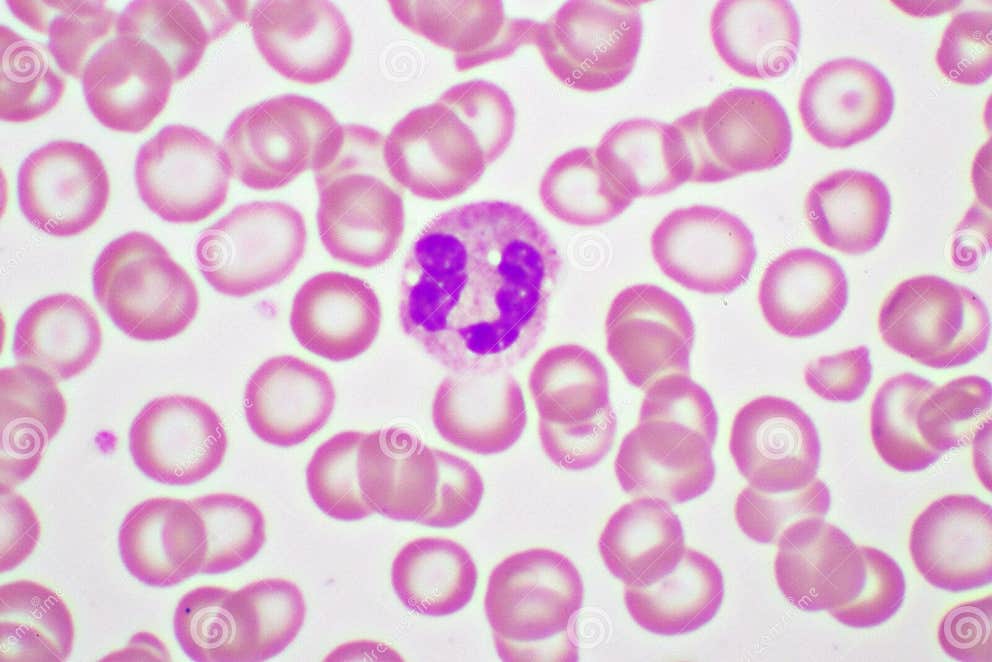 Segmented Neutrophil Cell in Human Blood Smear Stock Image - Image of ...