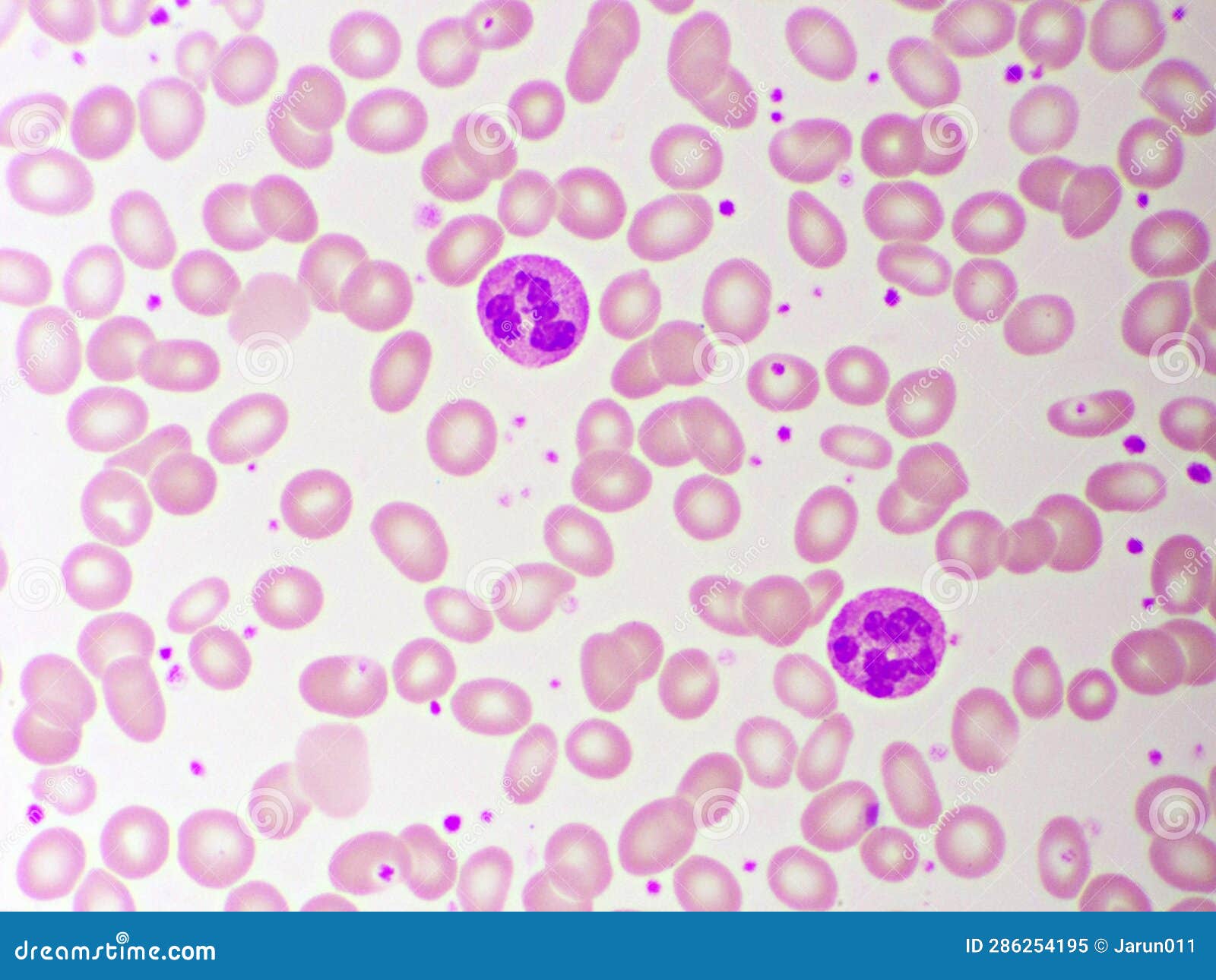 Segmented Neutrophil Cell In Human Blood Smear Royalty-Free Stock Photo ...