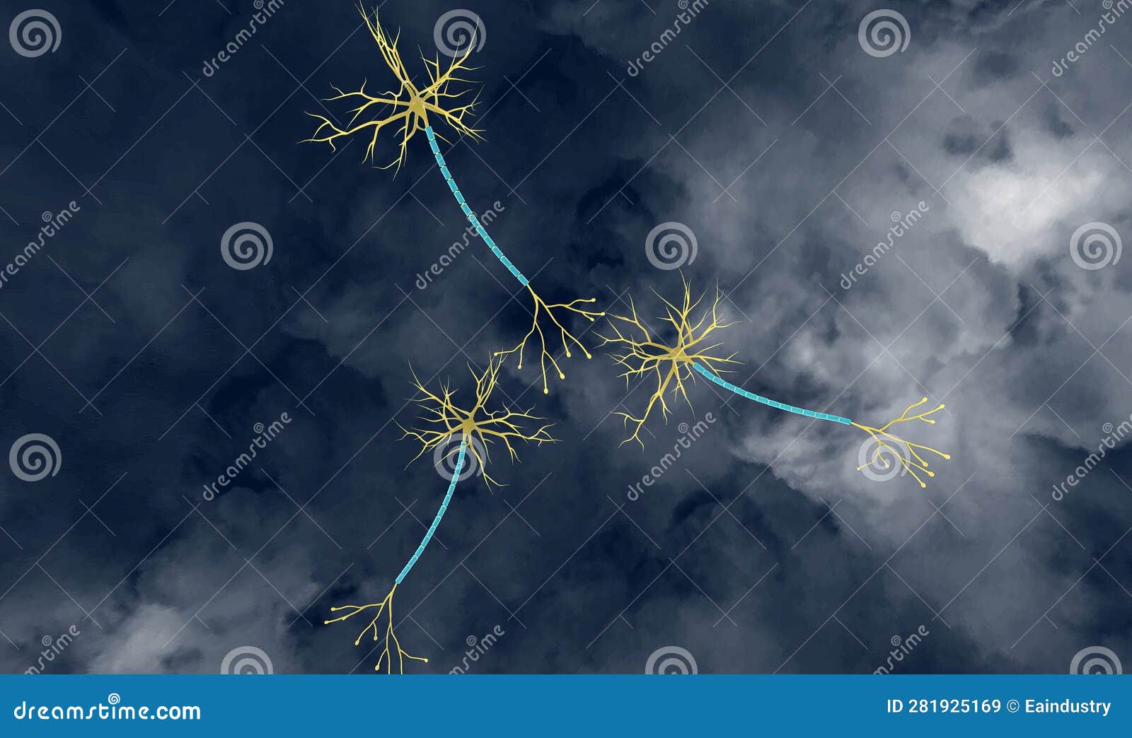 Seizure Caused by Abnormal Electrical Activity in Brain Stock ...