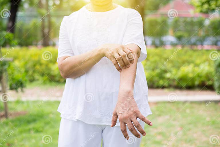 Senior Asian Woman With Rash Or Papule And Scratchon Her Arm From
