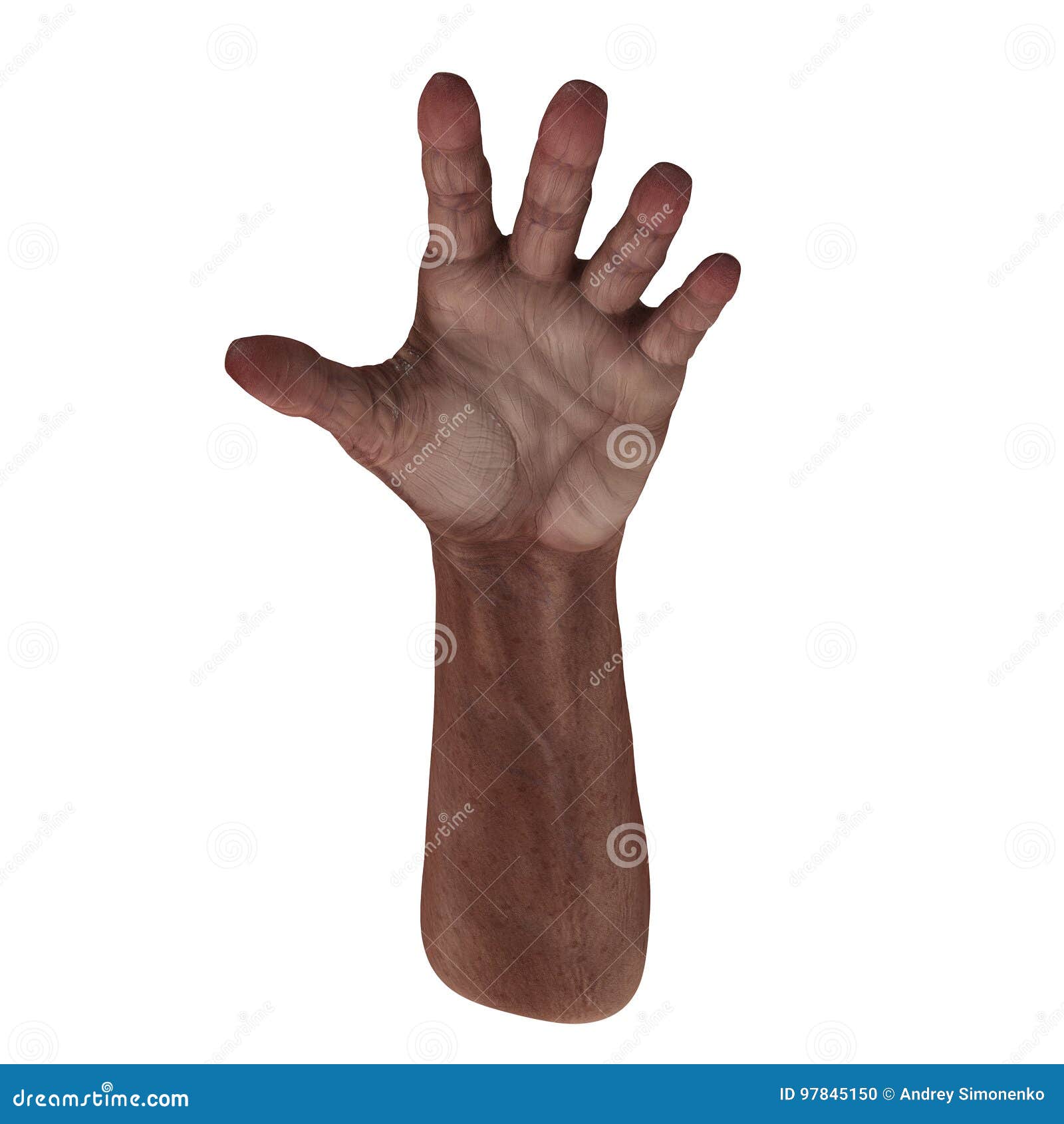 Hands With Rheumatoid Arthritis Disease In Cartoon Flat Style. Vector ...