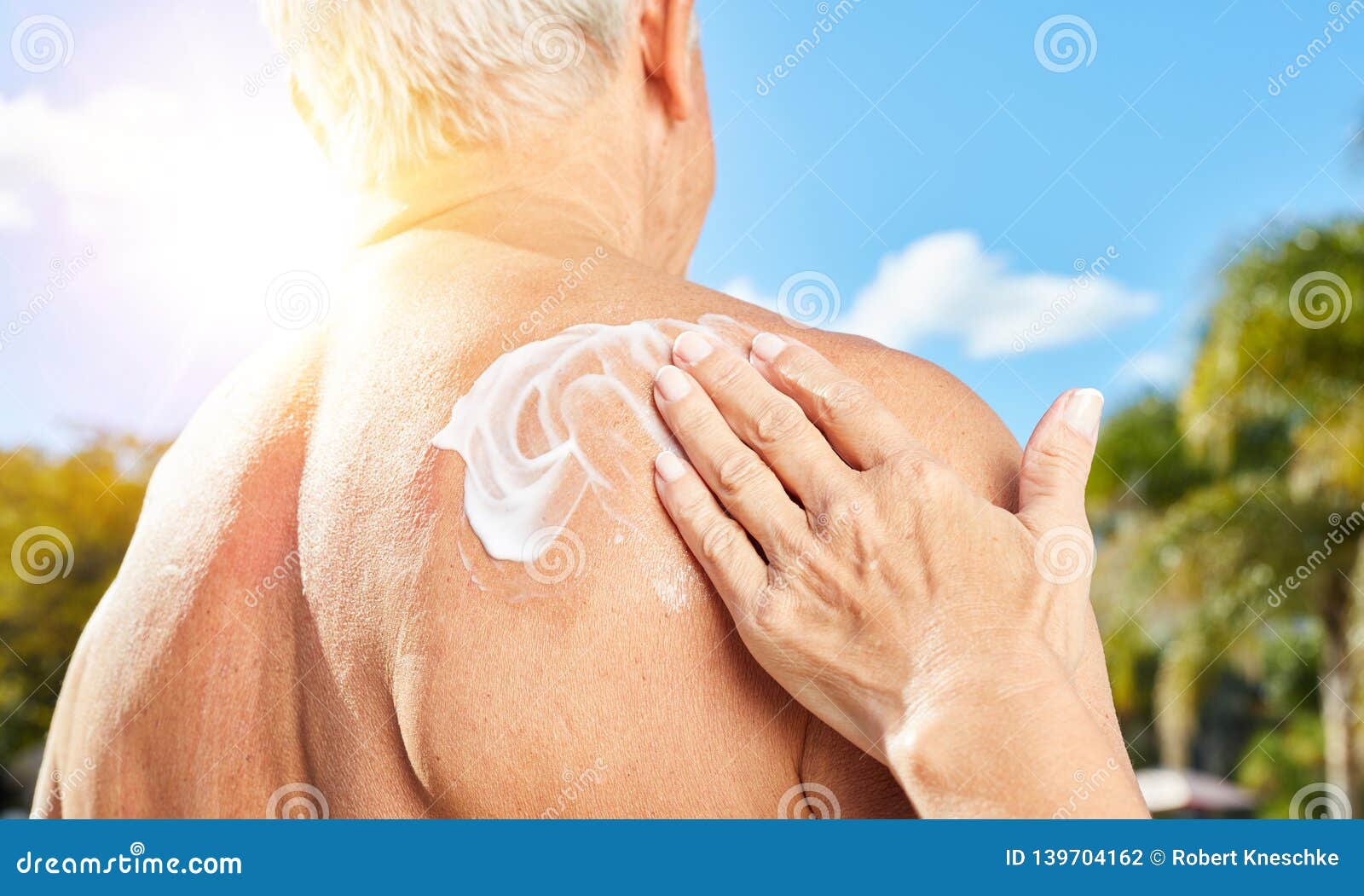 Senior Man with Sunscreen on His Back Stock Photo - Image of body, skin ...