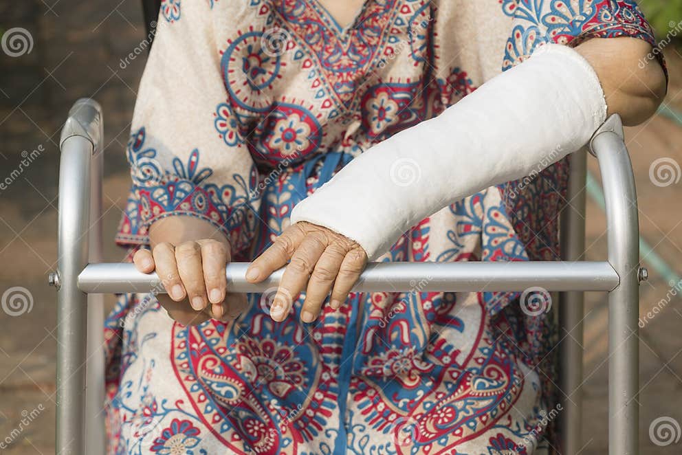 Senior Woman Broken Wrist Using Walker. Stock Image - Image of cast ...