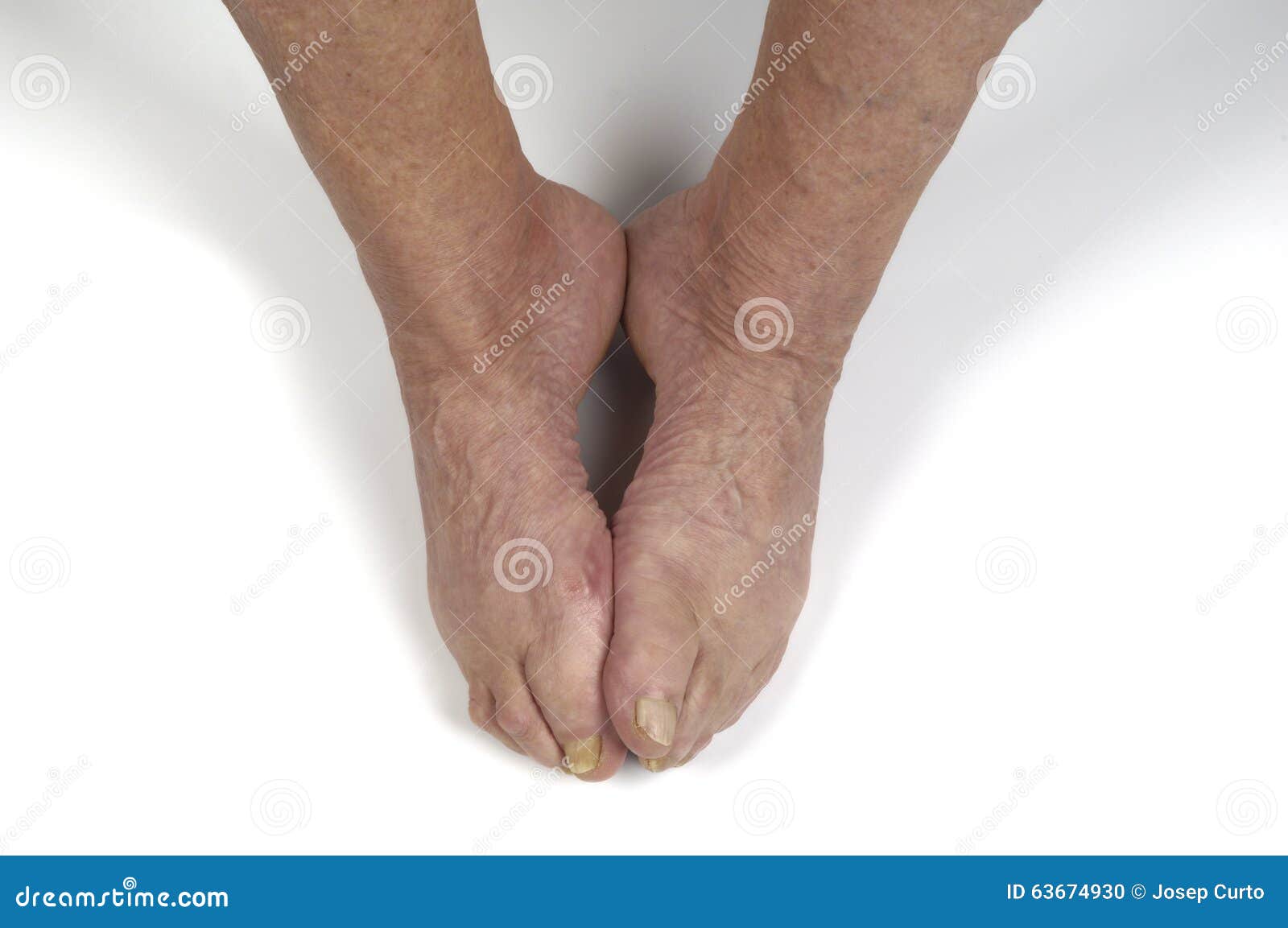 Senior woman foot stock photo. Image of pain, exam, human - 63674930