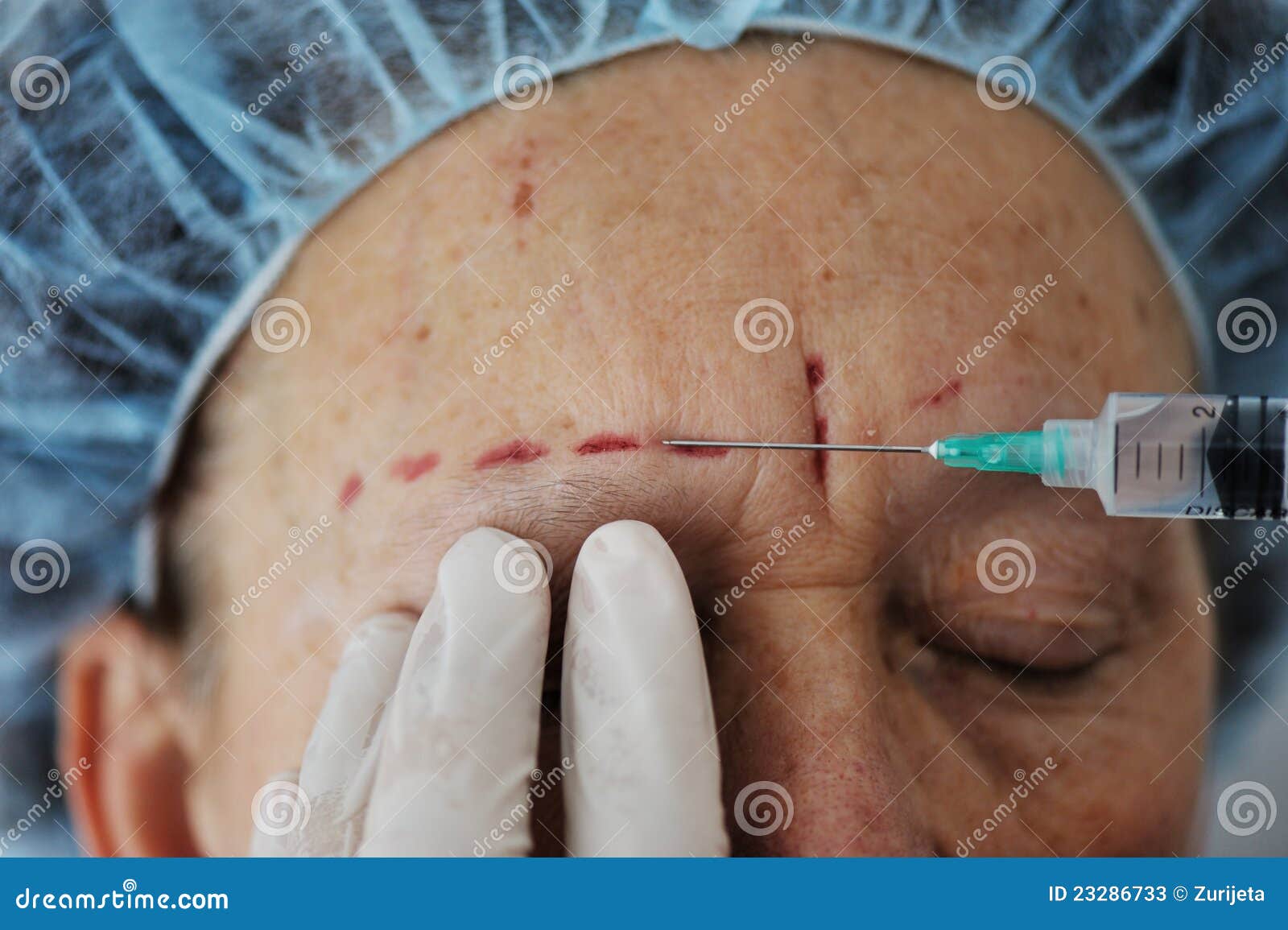 Senior Woman Getting Botox Injection Stock Image - Image of mature ...