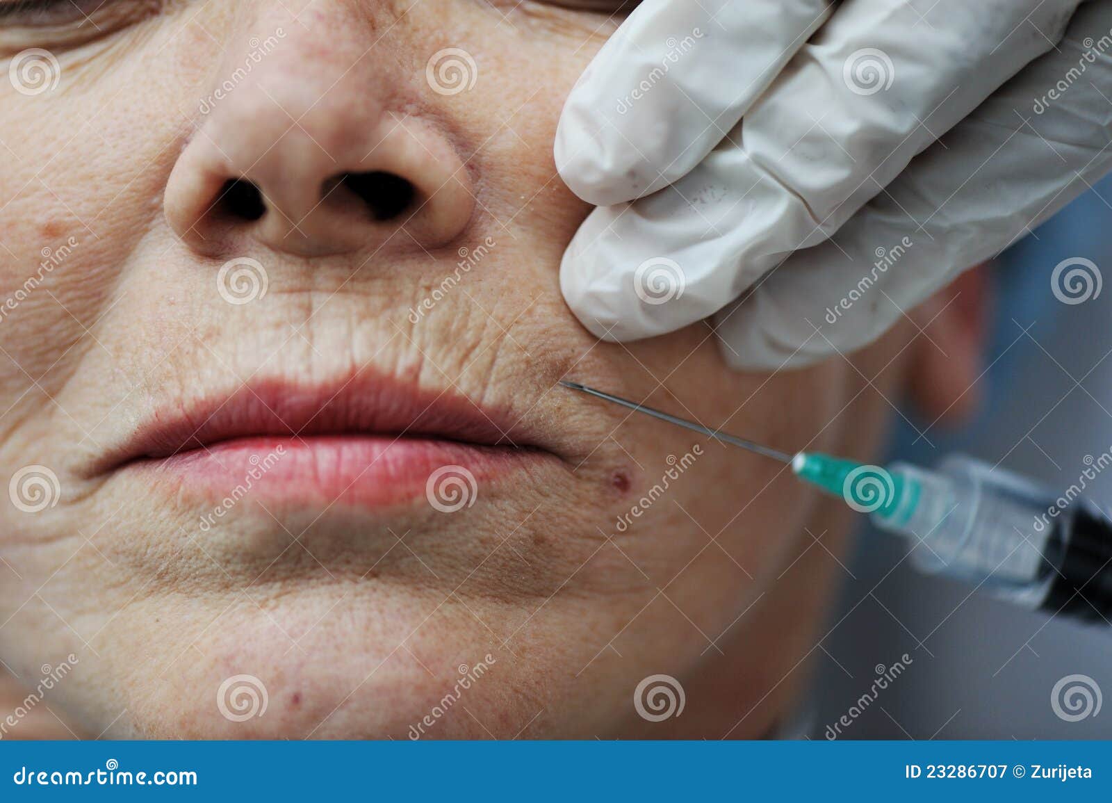 Senior Woman Getting Skin Injection Stock Image - Image of appearance ...