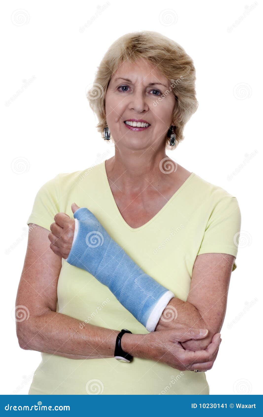 Senior Woman Holding Left Arm in Cast Stock Image - Image of injury ...
