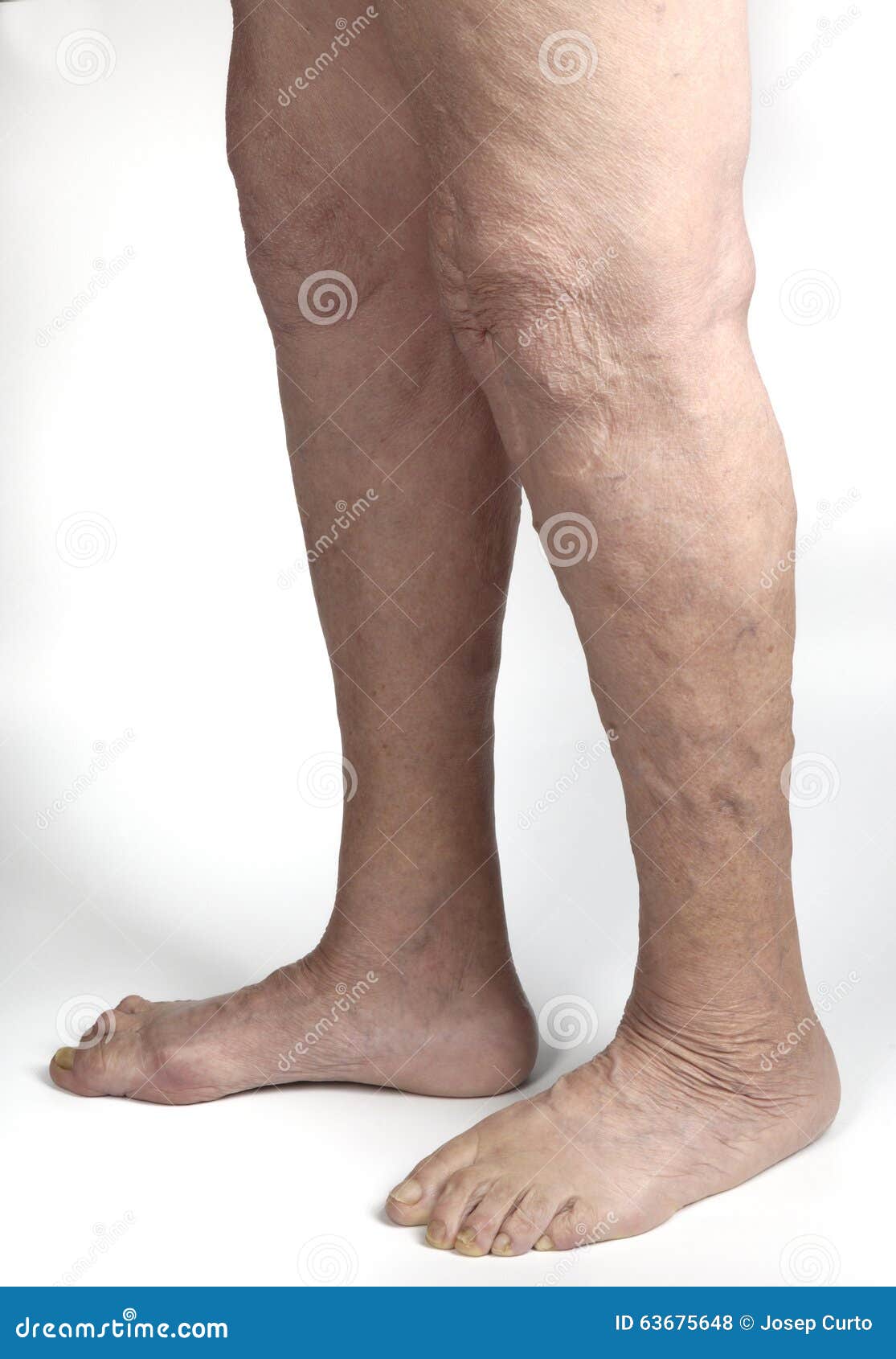Senior woman leg stock photo. Image of healthcare, finger - 63675648