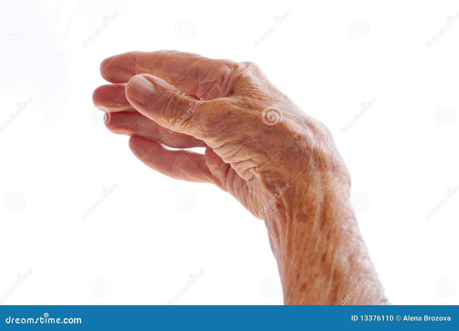 Damaged Knuckles Stock Photos - Free & Royalty-Free Stock Photos from ...