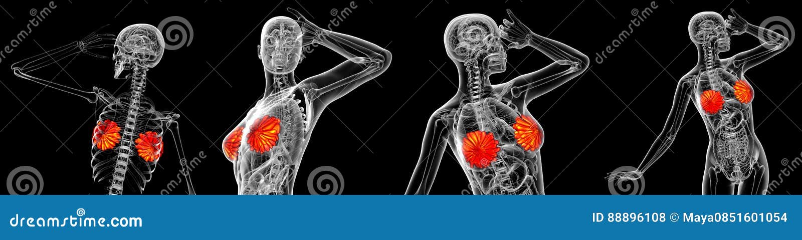 Seno umano illustrazione di stock. Illustrazione di ferita - 88896108