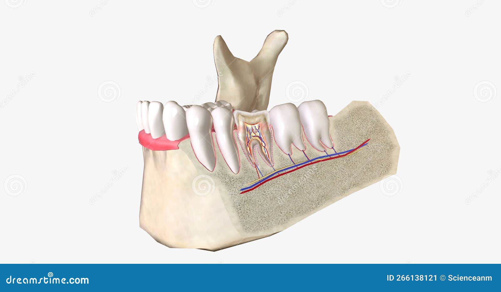 Sensitive Teeth is a Common Dental Condition Characterized by Sharp ...