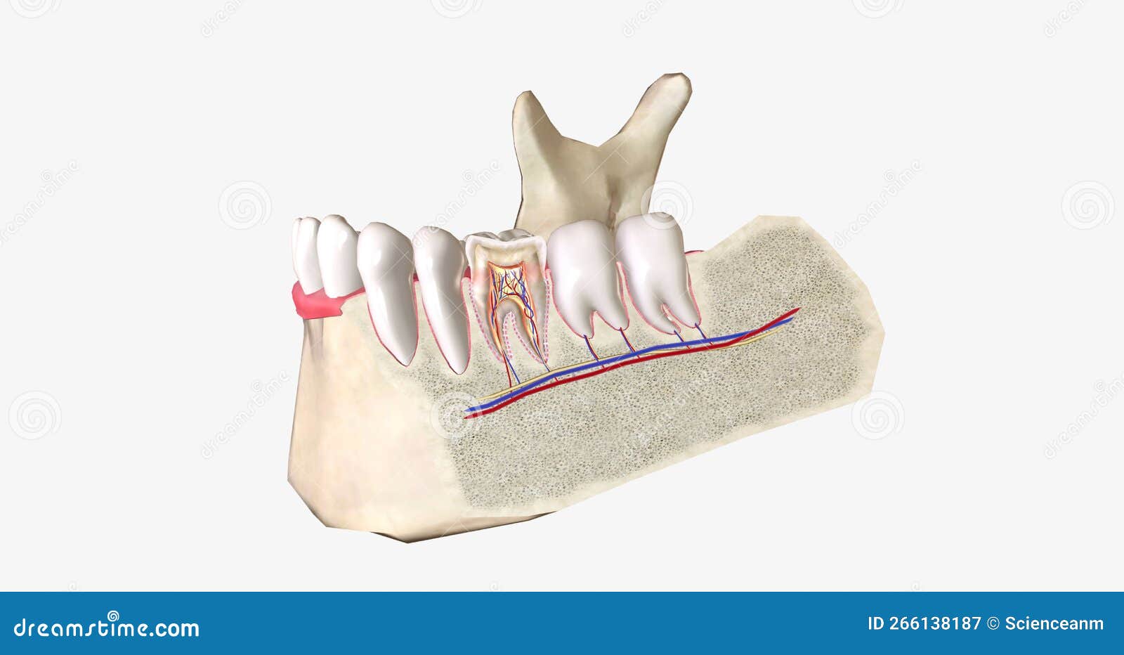 Sensitive Teeth is a Common Dental Condition Characterized by Sharp ...