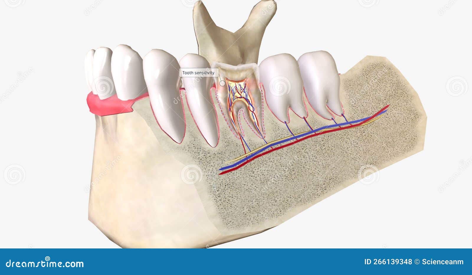 Sensitive Teeth is a Common Dental Condition Characterized by Sharp ...