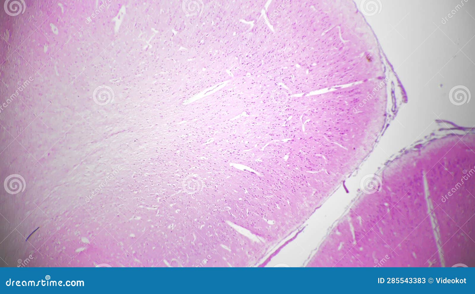 Sensory Cortex in Section of Human Magnified in 40 Times Under ...