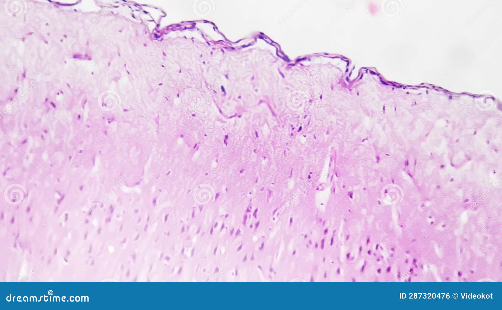 Sensory Cortex in Section of Human Magnified in 200 Times Under ...