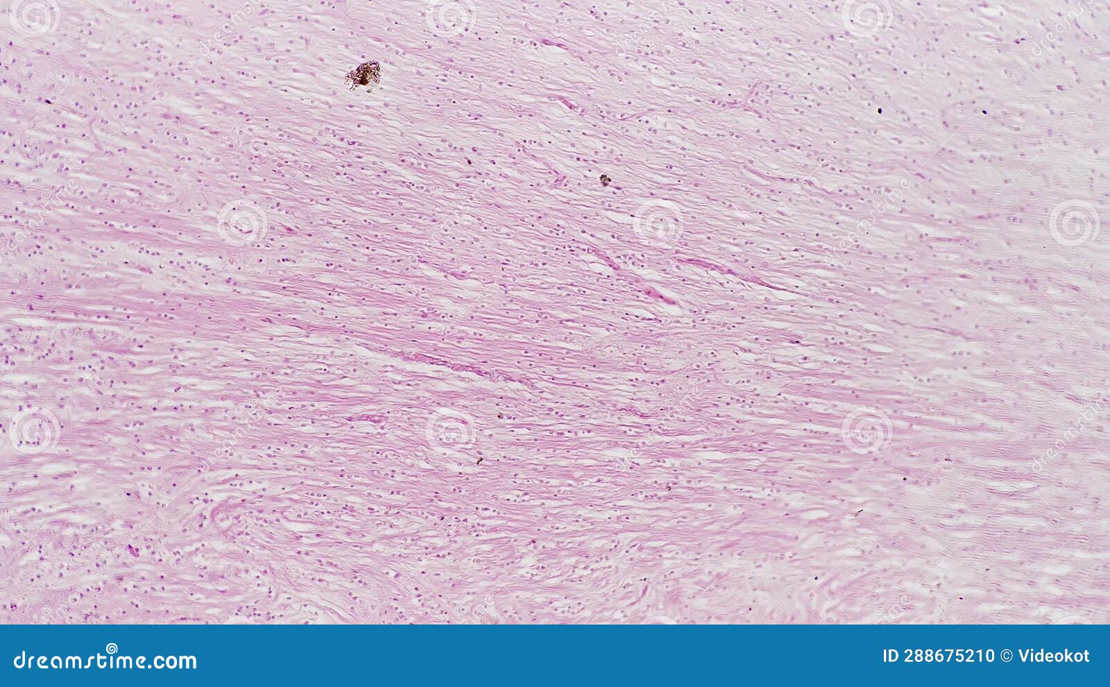 Sensory Cortex in Section of Human Magnified in 100 Times Under ...