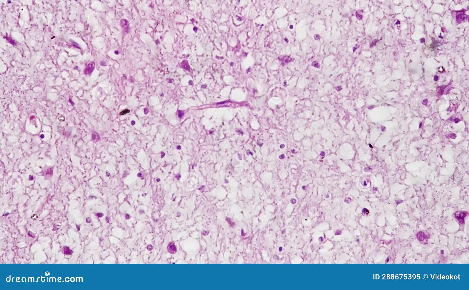 Sensory Cortex in Section of Human Magnified in 400 Times Under ...