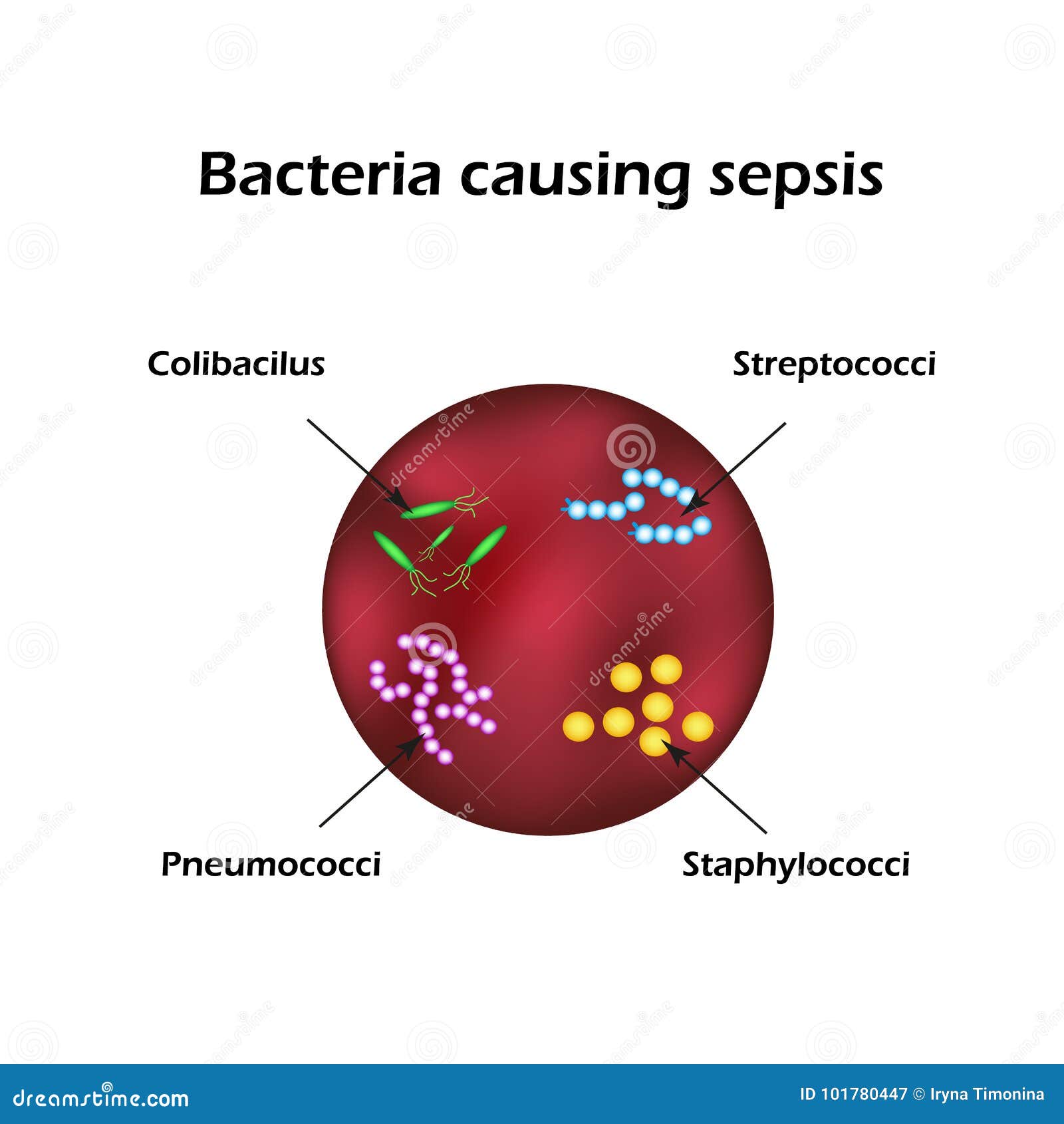 Sepsis Setticemia E Coli Streptococchi Pneumococchi Stafilococchi Illustrazione Vettoriale ...