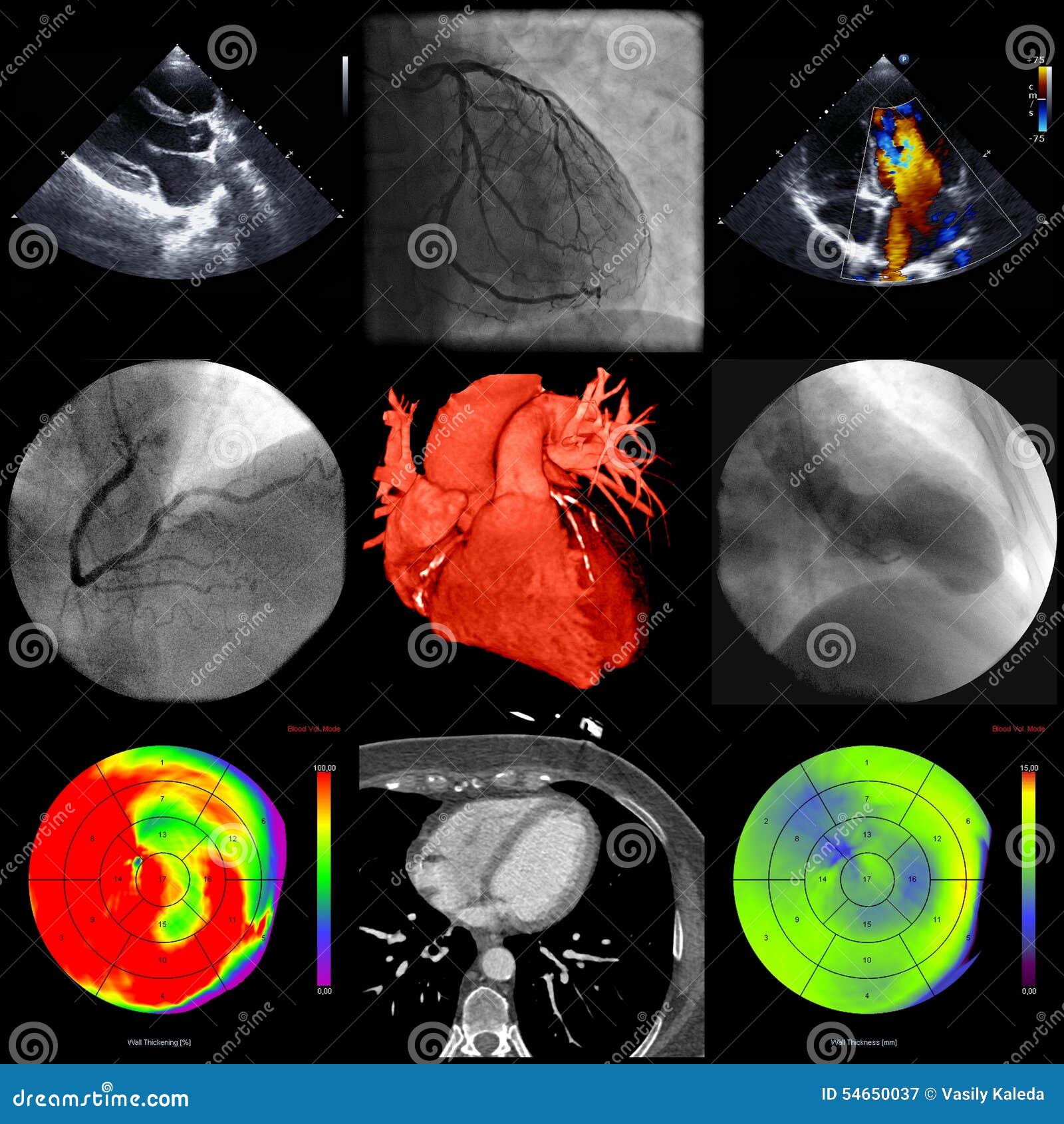 A Series of Cardiac Imaging with Different Techniques Stock Image ... A Series of Cardiac Imaging with Different Techniques Stock Image ...